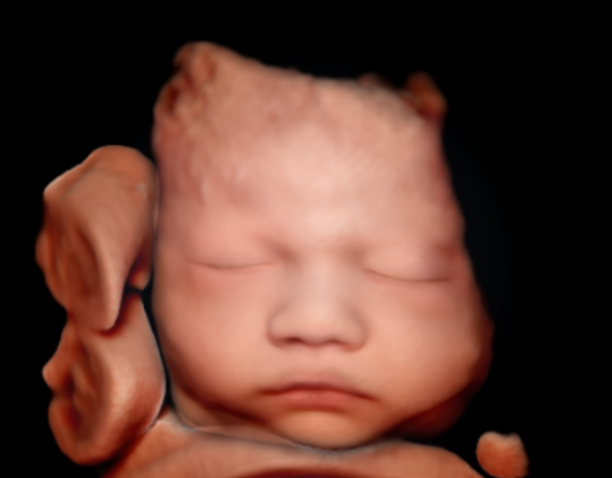 Samsung Healthcare Global